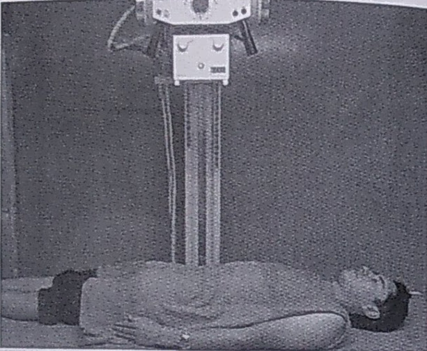 Flexandertes S.A. (sobreoficial asociado): Tallo de abdomen de estómago