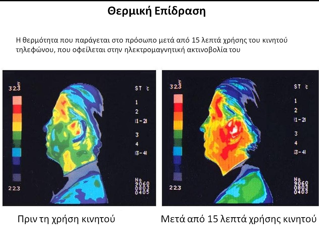 ΟΜΑΔΑ ΑΓΙΟΣ ΕΙΡΗΝΑΙΟΣ: ΧΡΗΣΗ ΚΙΝΗΤΟΥ