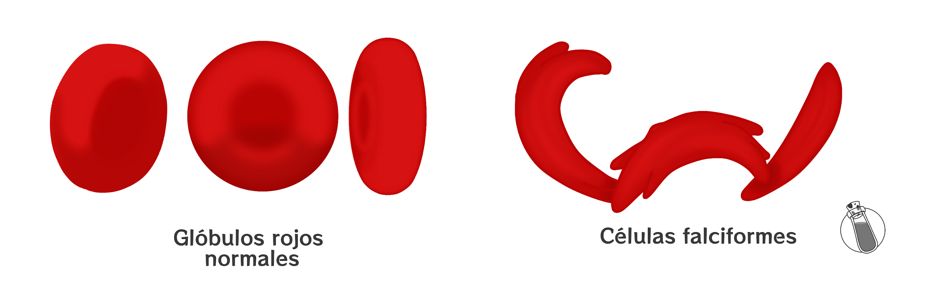 La forma de los eritrocitos