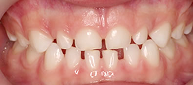 Dr. Luis Pastor González V. Ortodoncista-Odontólogo: DENTICION ...