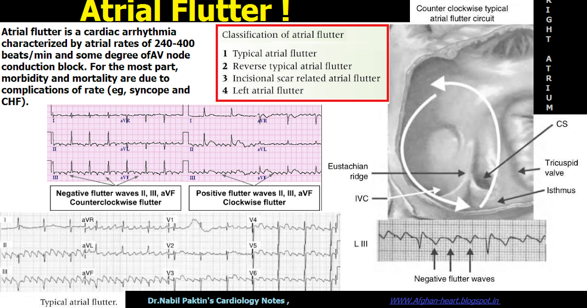 Dr.Nabil Paktin's Journal of Cardiovascular Medicine Blog ژورنال ( قلب ...