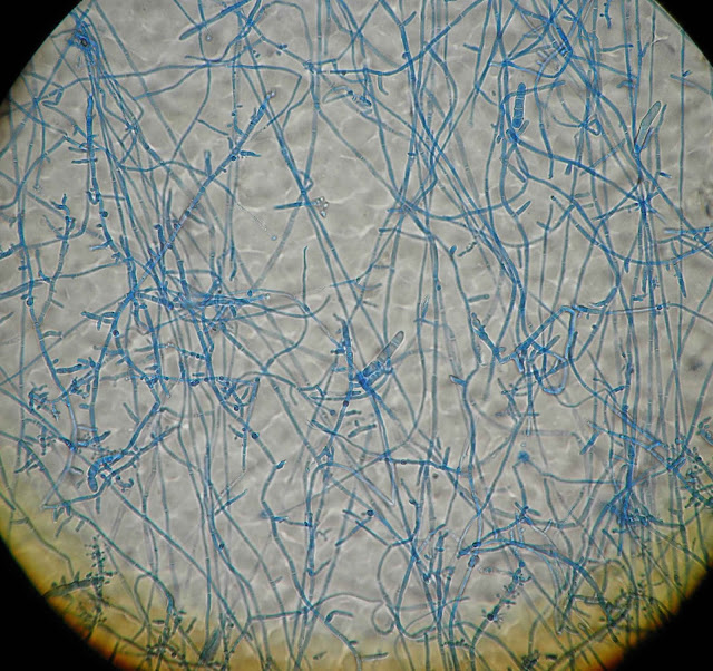 ATLAS MICOLOGIA: TRICHOPHYTON INTERDIGITALE