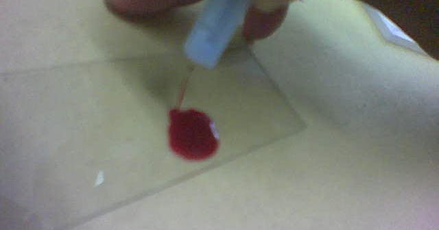 CLIN CHEM EXPLORER: What capillary puncture is and how it is performed