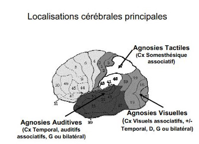 Un médecin du sport vous informe: Les troubles de la perception (agnosies)