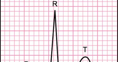 How to read an Electrocardiogram (ECG) - Part 1, PQRST Waves | Nurselk.com