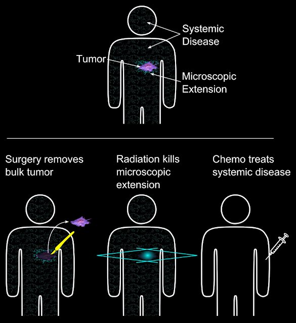 Radiologic: How does cancer treatment work?