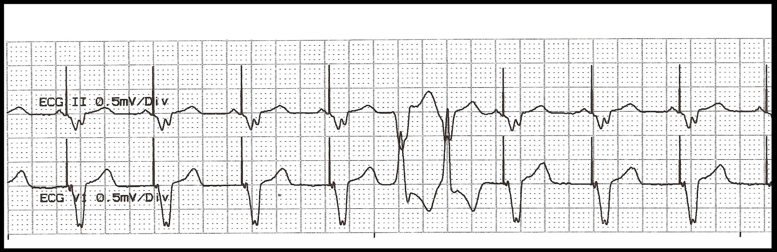 Basic EKG Rhythm Test 34