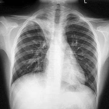 Nos.: Golden S sign.