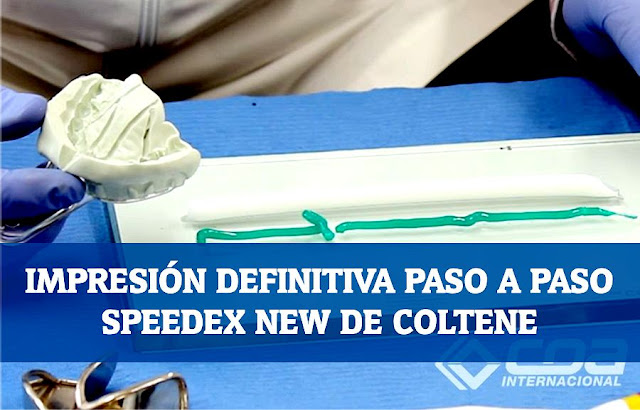 IMPRESIÓN DEFINITIVA Paso a Paso con Speedex NEW de Coltene