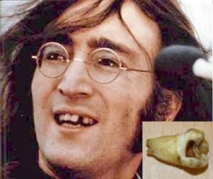 Diente de John Lennon a Subasta | El Mundo al que...