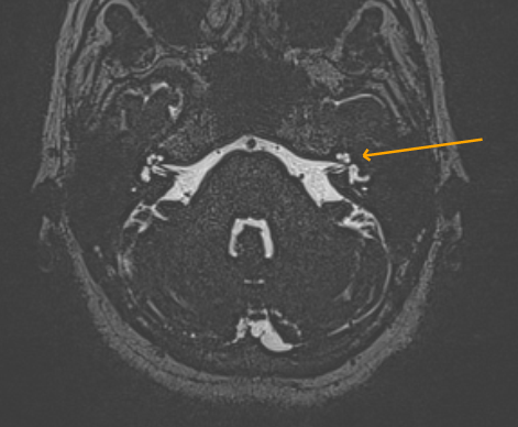 learning mri: June 2013