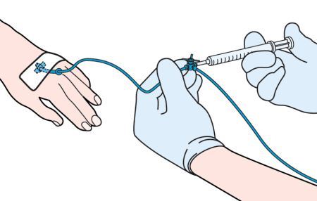 Pengobatan Kanker dengan Kemoterapi | Medkes