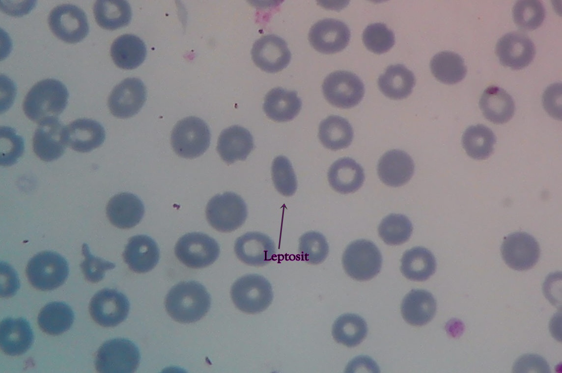 Rizqi Murtafi'ah: Oktober 2011