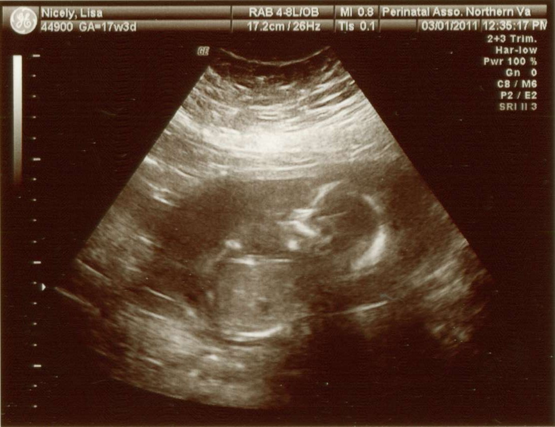 Mike and Lisa Start a Family: Some Good News and Baby Clothes...