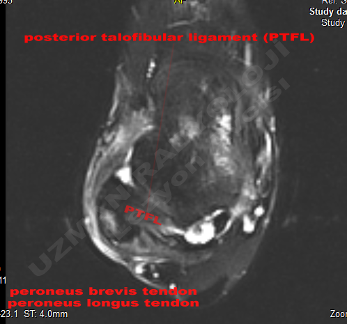 Uzman Radyoloji; lezyon avcısı: Kasım 2011