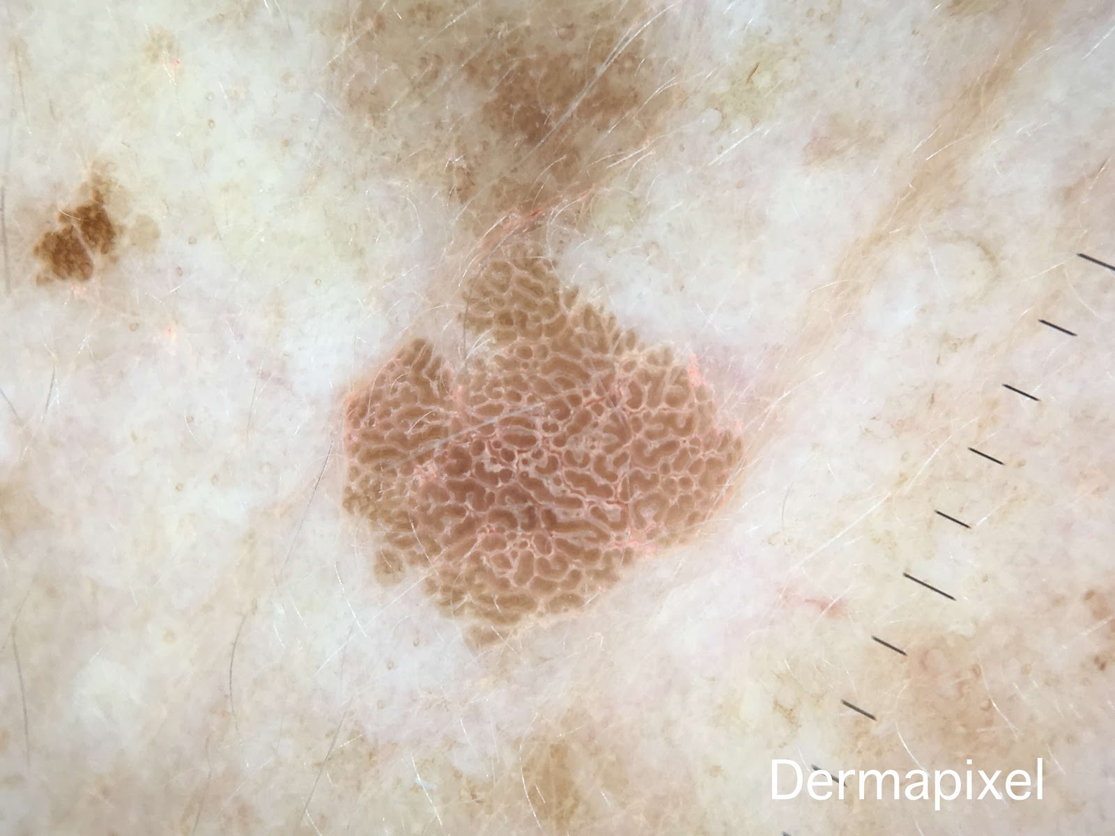 Dermapixel: enero 2020