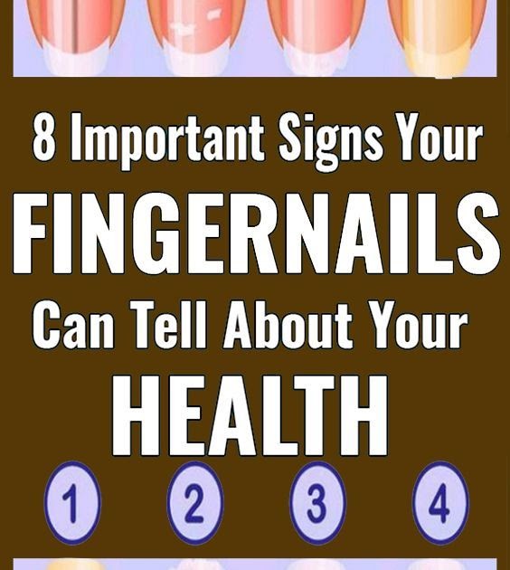 8 Important Signs Your Fingernails Can Tell About Your Health ...