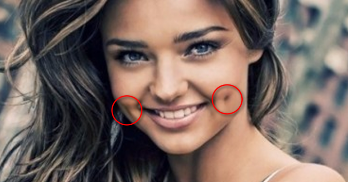 What It Really Reveals If You Have Dimples On Your Cheeks | Savvy Life Mag+