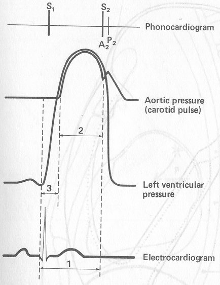 Pedi cardiology: Systolic timings - EKG, Pressure Traces...