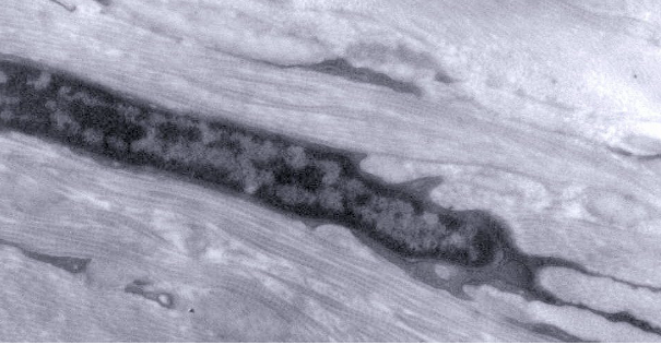 Histologia : Tecido Conjuntivo