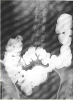 PROTOCOLO DE ESTUDIOS ESPECIALES: TRÁNSITO INTESTINAL