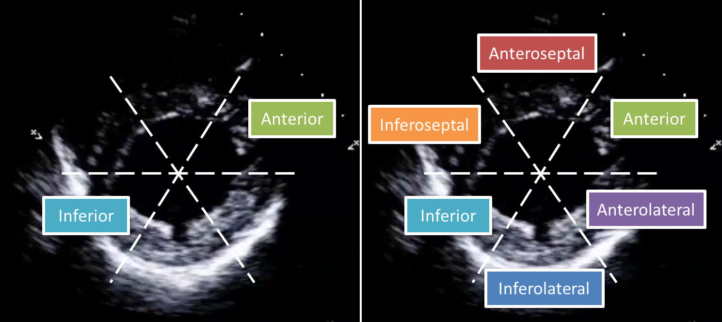 CVT Mohd Farid: ECG & Echocardiography Case Study Chronic Myocardial ...