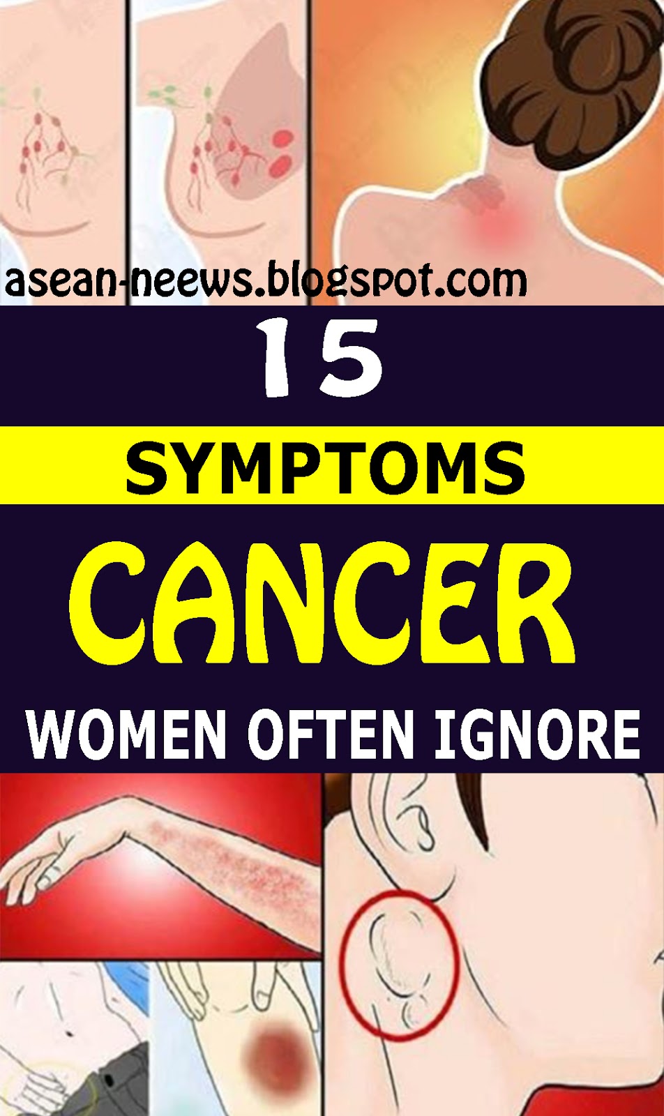 15 Cancer Symptoms Women Often Ignore