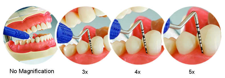 Dental Loupes $199,Surgical Loupes,Medical Loupes | Schultz: 2017
