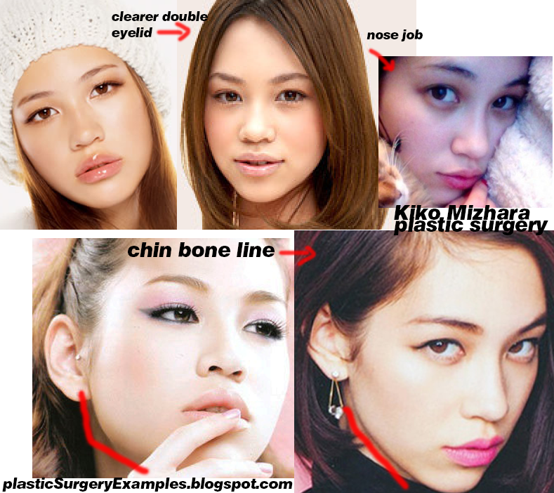 Plastic Surgery Examples: Kiko Mizuhara plastic surgery before & after ...