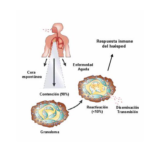 egofisicoyquimico: Tuberculosis