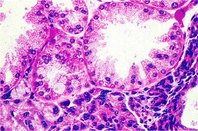 POURQUOI TU PLEURES ?: L'appareil lacrymal