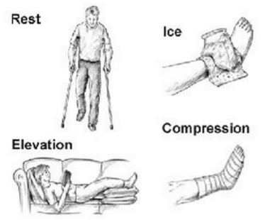 Batang_Fisioterapi: Cedera yang sering terjadi pada saat olahraga tenis ...