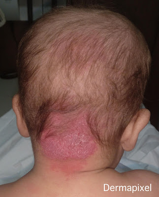 Dermapixel: abril 2020