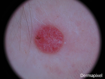 Dermapixel: enero 2021