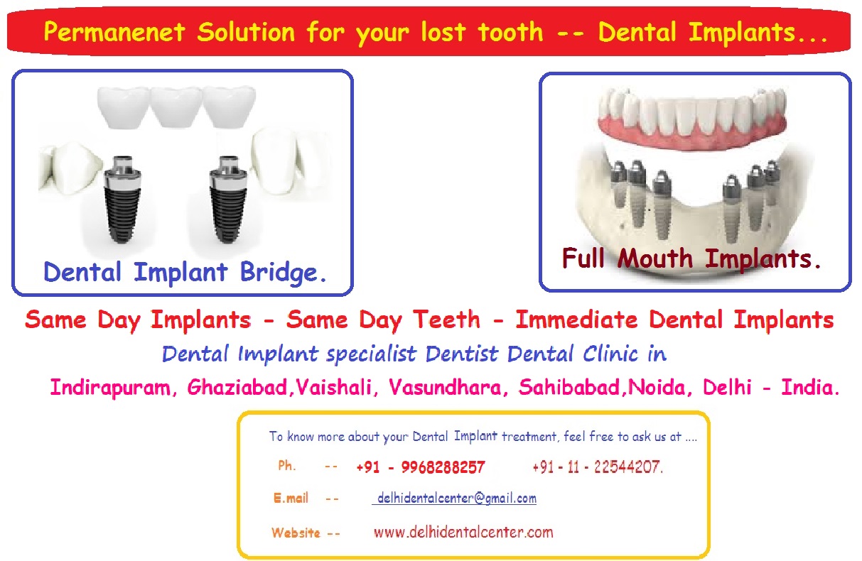 Smile Designing Delhi: Delhi Dental Center, Top Best Painless Flapless ...