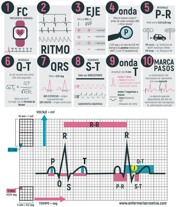 Electrocardiograma repaso rápido + VIDEO - Medicina mnemotecnias
