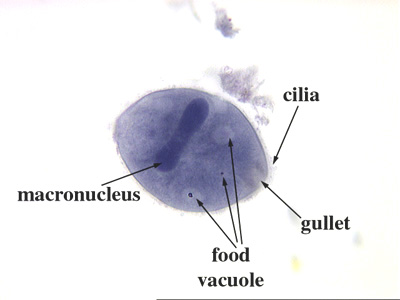 Sil 'Vet' Bullet: Balantidium coli