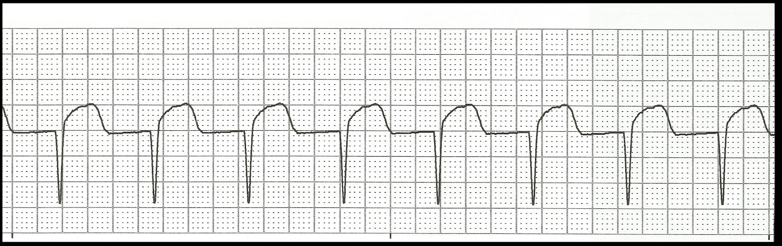 Basic EKG Rhythm Test 07