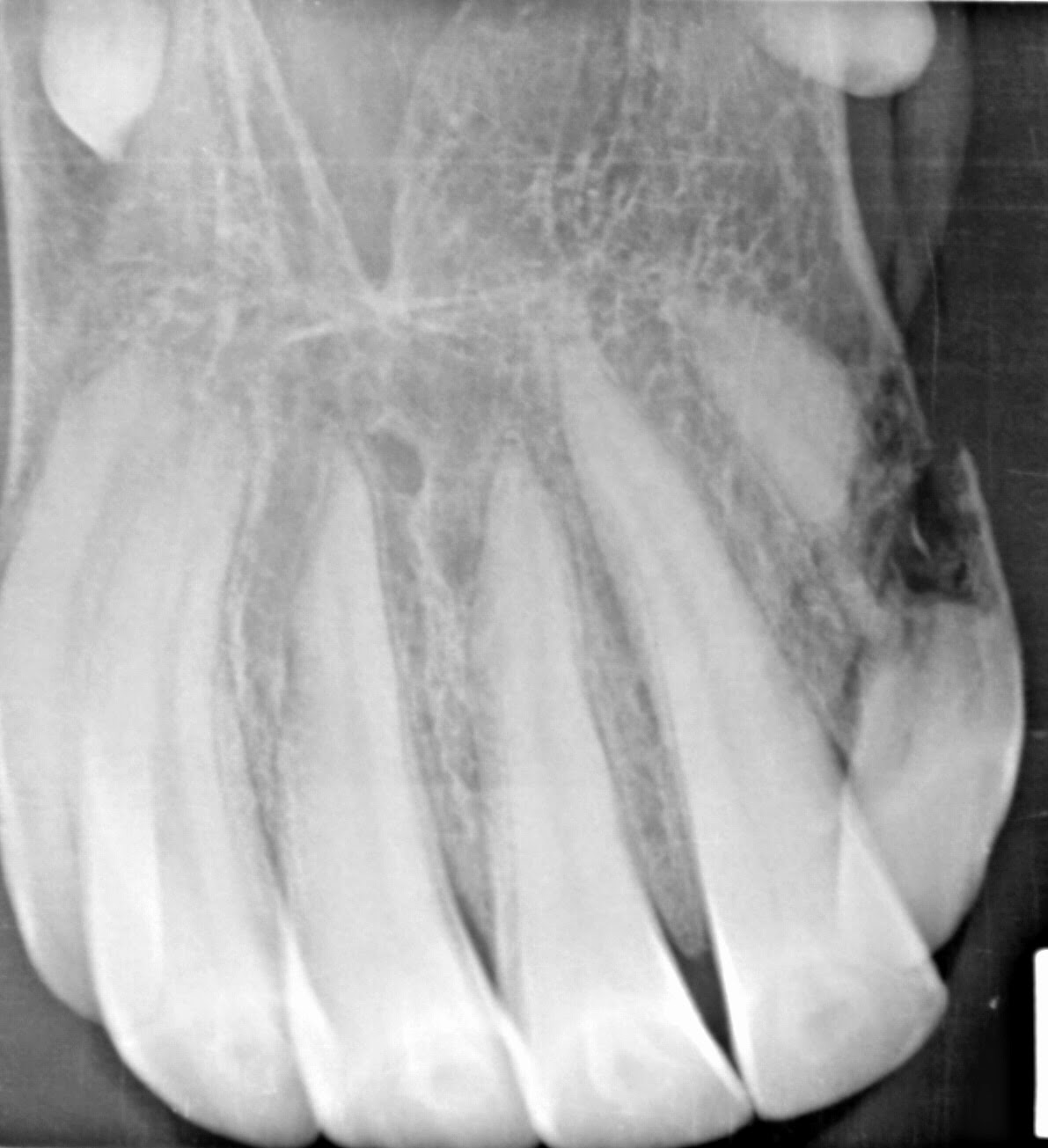 Equine Dentistry: Equine Odontoclastic Tooth Resorption and ...