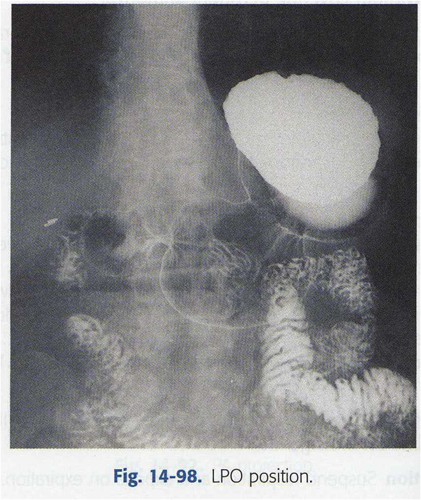 Catatan Ku: Oesophagus Maag Duodenum (OMD)