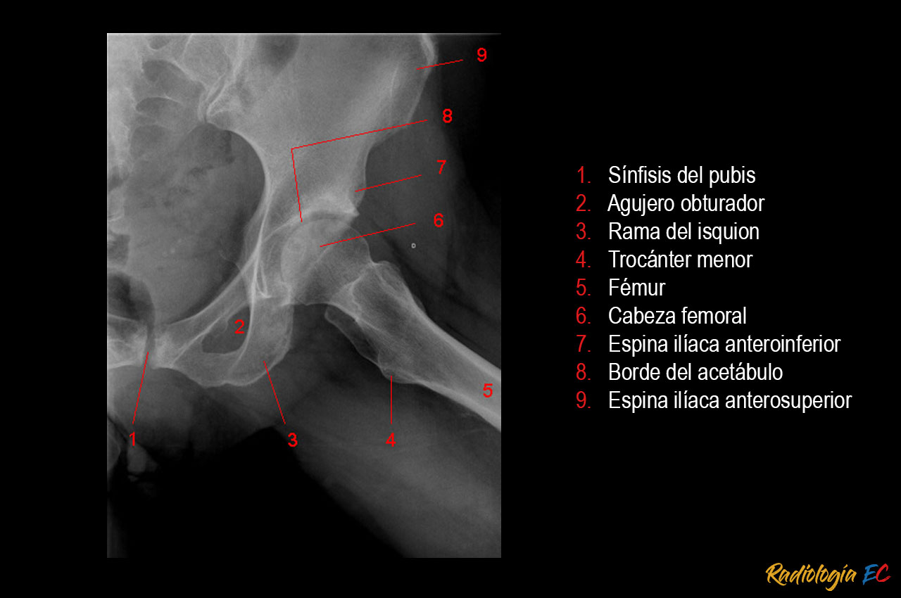 Solo imágenes abdomen, pelvis y cadera