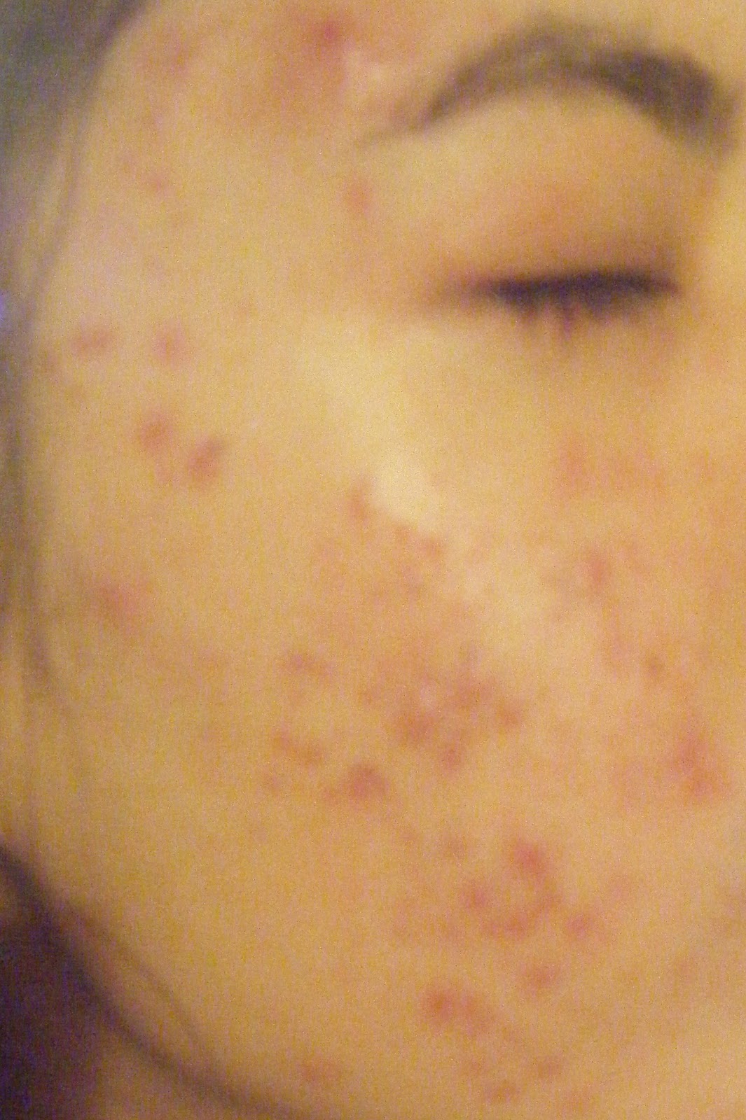 KEEP CALM AND HAVE CLEAR SKIN ♥: June 2012