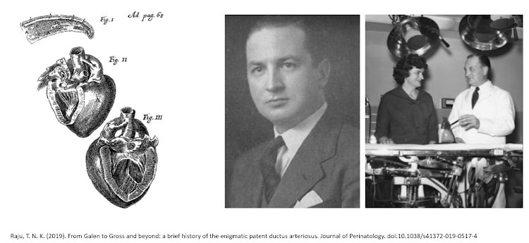 Ductus arterioso : historia, embriología e histología. ~ Cardiopedia