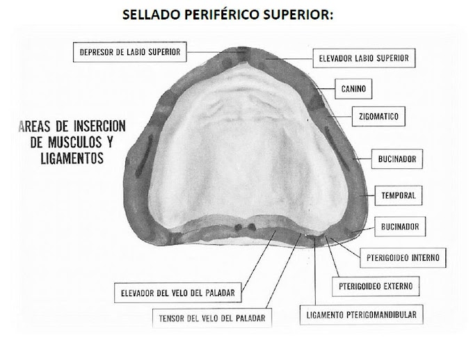 La XEROSTOMÍA en pacientes con Prótesis Dental
