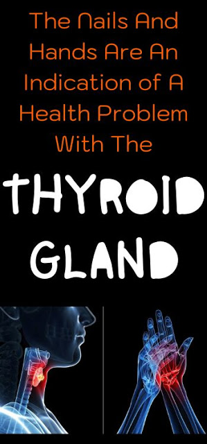 Do you have hypothyroidism? Look at your hands - wellness magazine