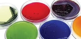 SOP for Growth Promotion Test of Microbiological media - PharmaSOPcorner