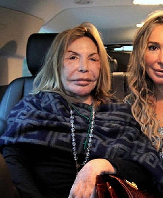 World Of Technology: Elsa Patton:The Worst Example Of Plastic Surgery ...