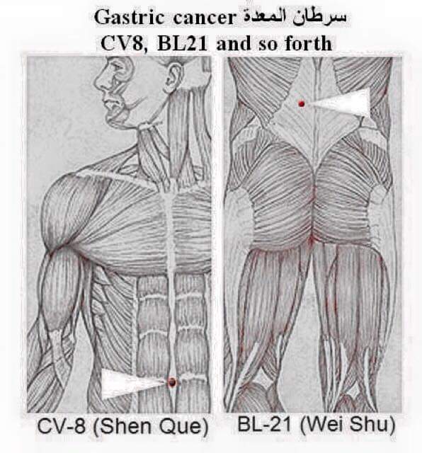 Pijat Urut Kelapa Gading: Urut meridian Lambung lengkap