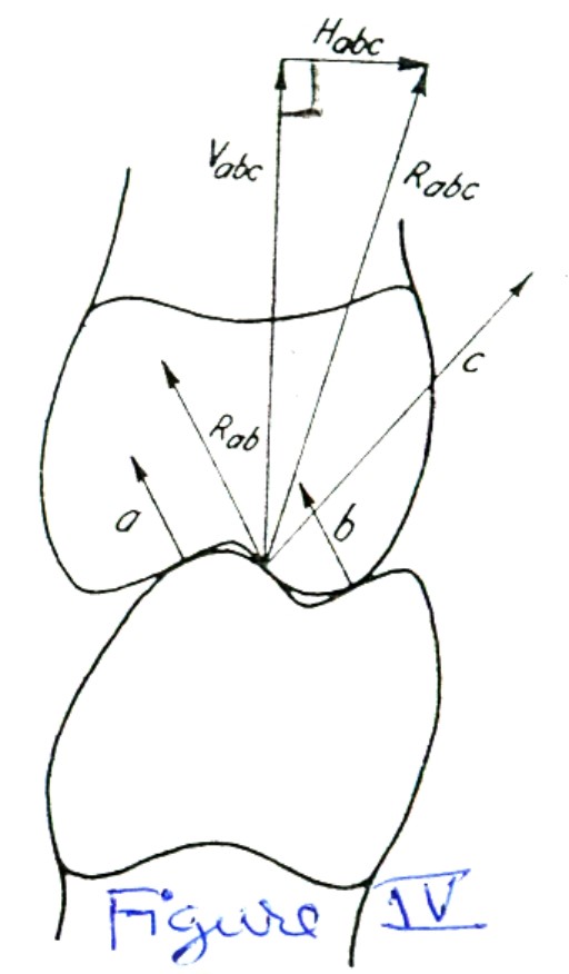 Dental Dreamz: Forces Acting on Restorations- A Seminar