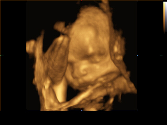 My Simple but Nice Life: 3D/ 4D Scan Baby Scan - 26 Weeks Di Vision College